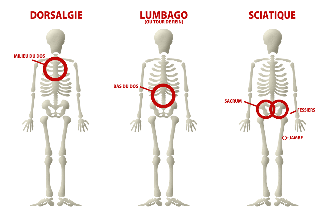La souffrance du dos par Jem Consulting Alsace.